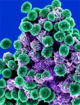 Staphylococcus - Estafilococos - Bactérias - InfoEscola