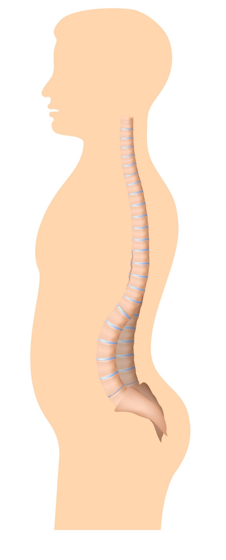 Lordose e Hiperlordose - Saúde e Postura - InfoEscola