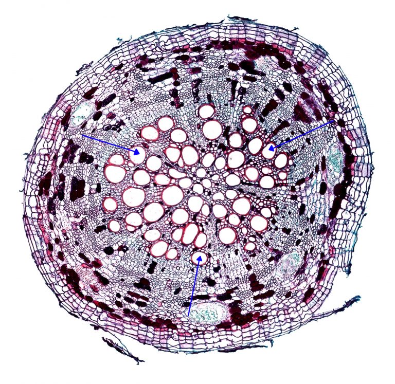 Xilema - Tecidos Vegetais - Histologia de Plantas - InfoEscola