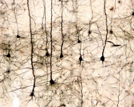 Neuroanatomia - Neurologia e Biologia - InfoEscola